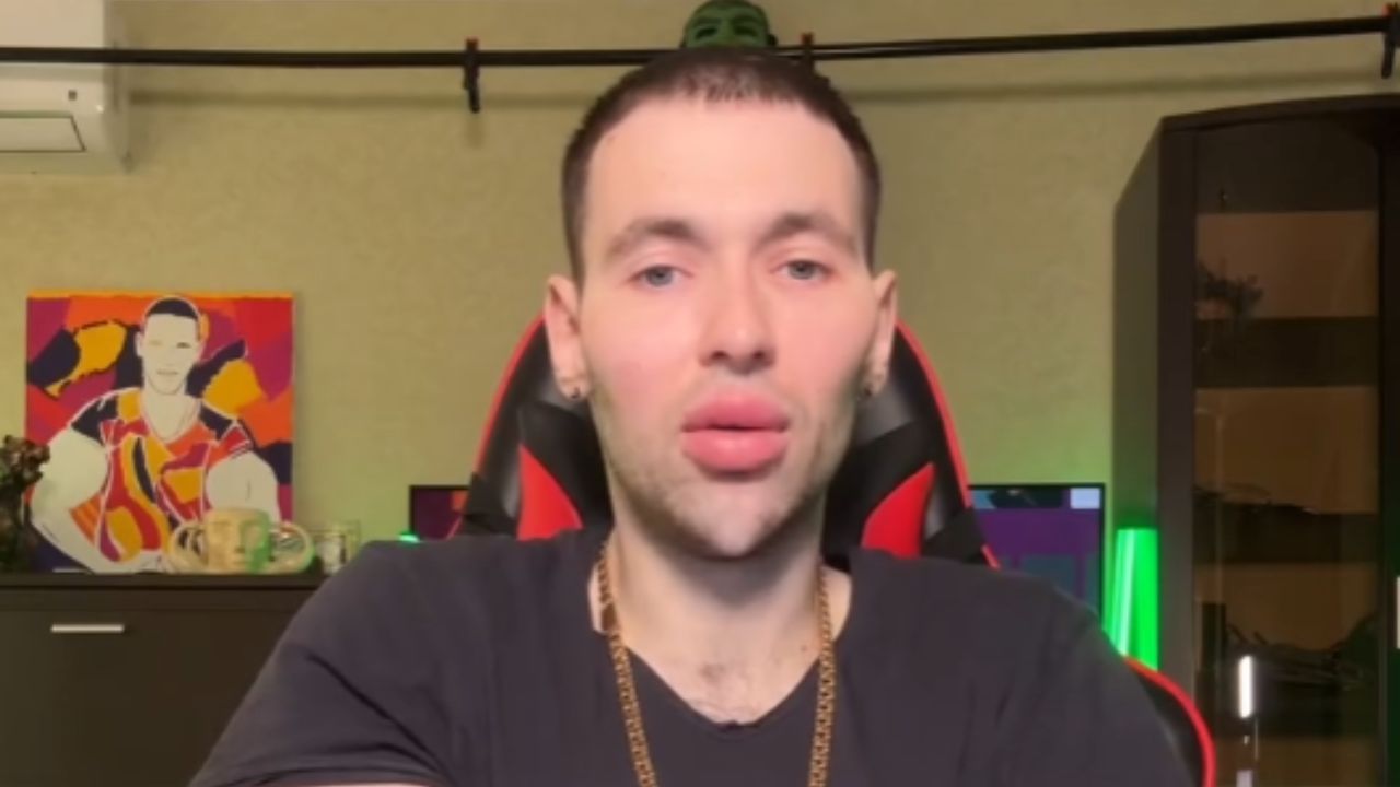 Influenciador conhecido como “Popeye Russo” passa por cirurgia de ...